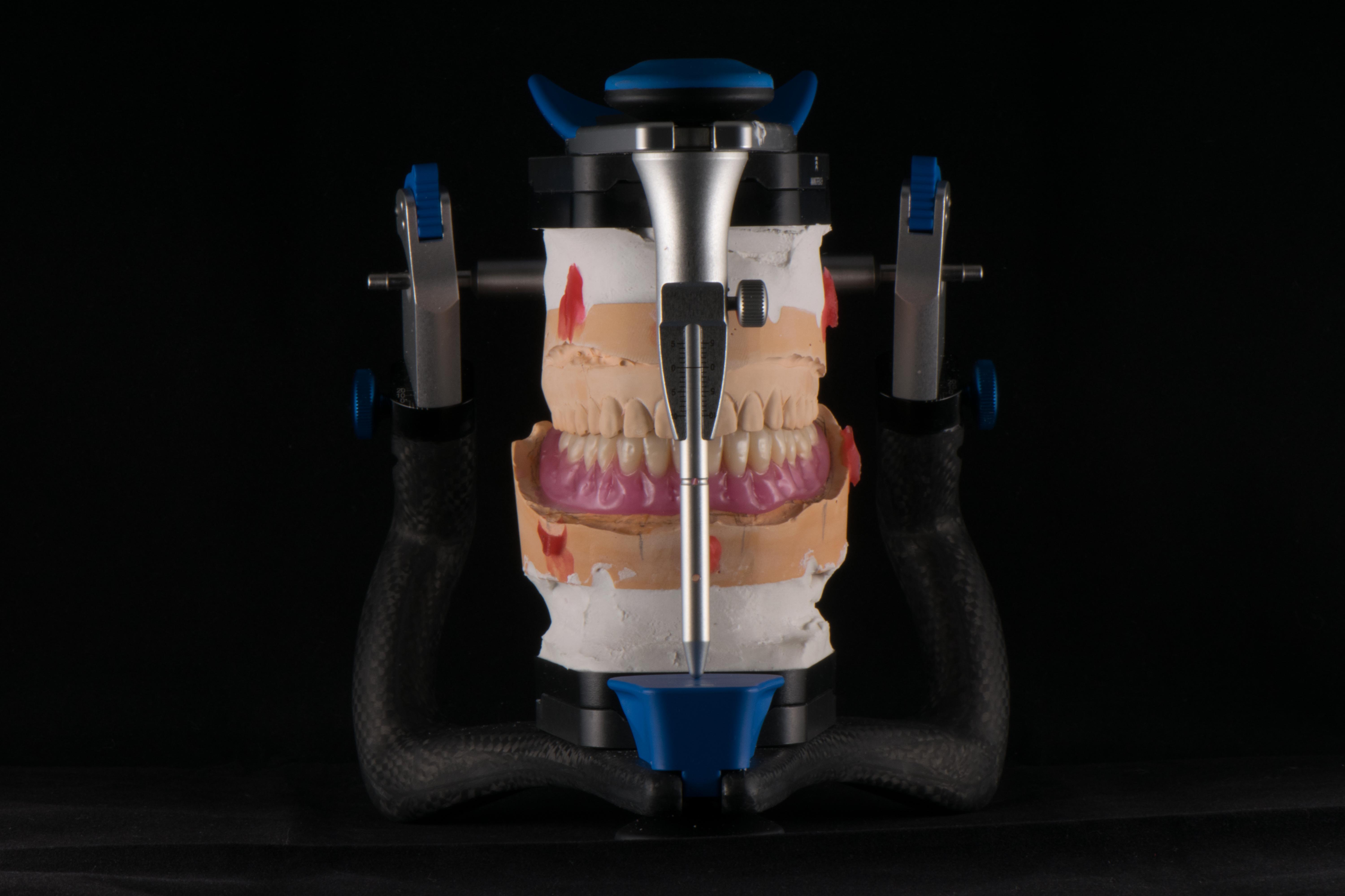 Dental News - Straumann Pro Arch concept with fully guided implant and ...